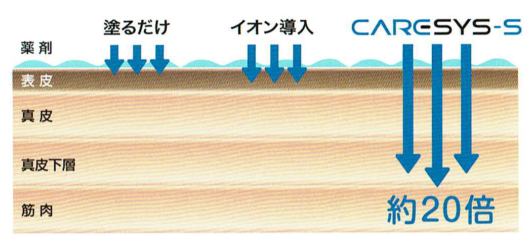 日本国内医療機関専売エレクトロポレーション CARESYS-S（ケアシス） - セシリアクリニック CECILIA CLINIC