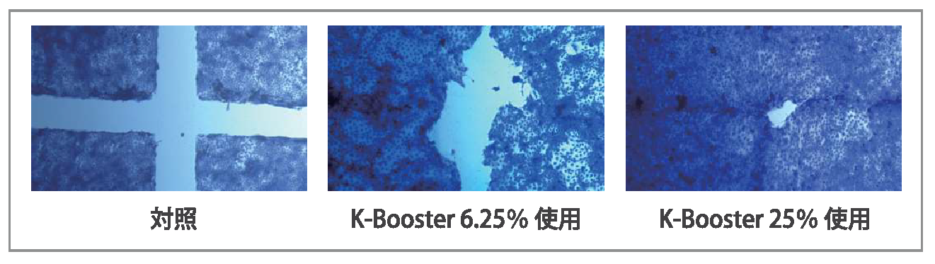 KBOOSTER - セシリアクリニック CECILIA CLINIC